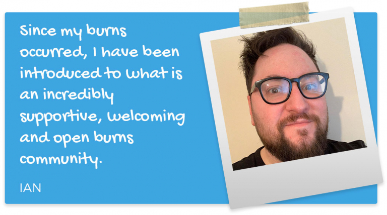 Dans Fund For Burns – Giving burn survivors the help they need